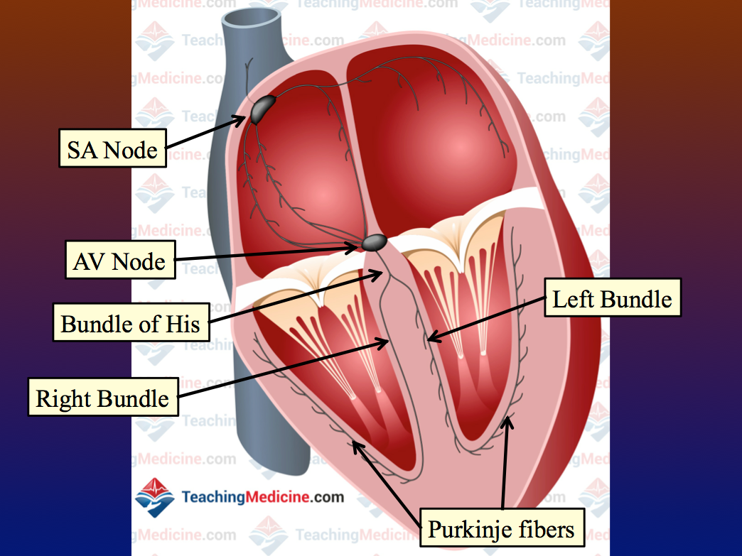 Teaching Medicine - Tutorial: Bundle Branch Blocks